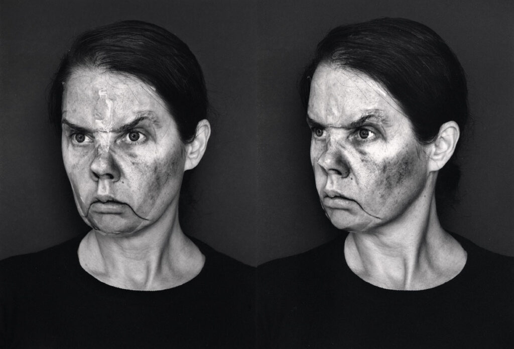 Family Skin - Hundred Heroines